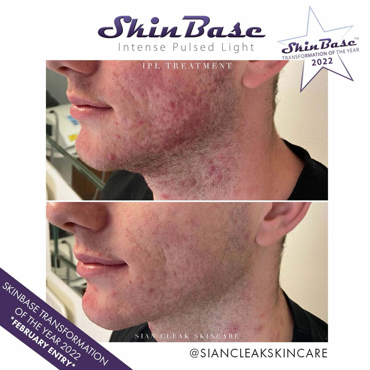 SkinBase Competition Recap